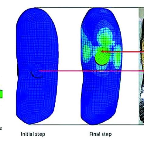 Structure Of Carbon Fiber Cf Ankle Foot Orthosis Afo Used For