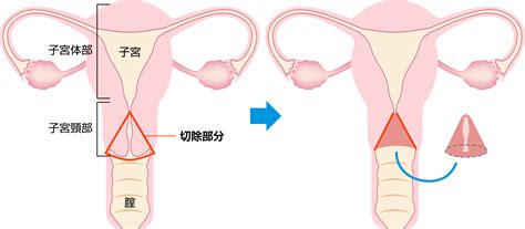 婦人科の手術 産科・婦人科の病気 日本医科大学多摩永山病院 女性診療科・産科