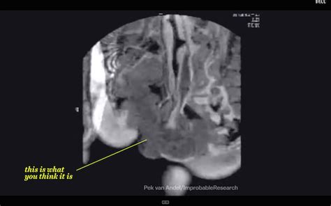 mri view of what really goes on inside your body when you