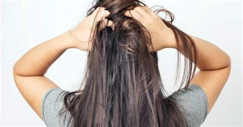 Dandruff Vs Dry Scalp 5 Crucial Things You Must Know