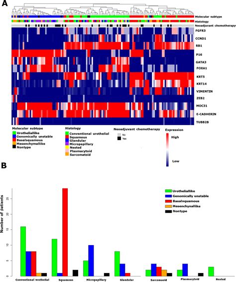 Intratumoral Heterogeneity Of Bladder Cancer By Molecular Subtypes And