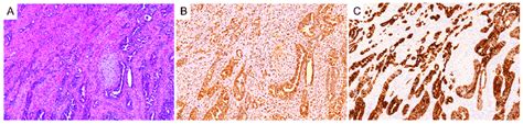 Representative Hematoxylin And Eosin Section Of A Uterine Download