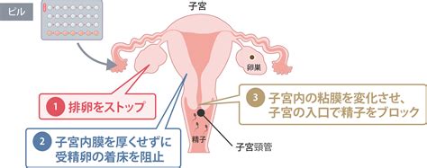 低用量ピル｜避妊と中絶｜医療法人オーク会