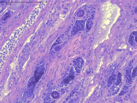 Microscopic Image Of M Dolomieu F 5730 Testis Showing Intersex