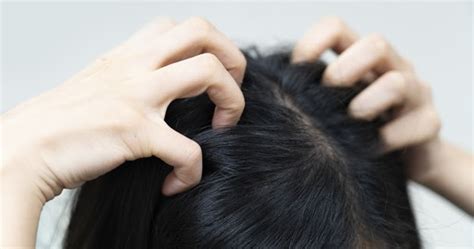 Natural Cures For Hair Falling Out In Clumps Treatment Hair And