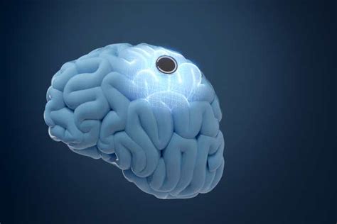 Elon Musks Neuralink Cleared For First International Brain Chip Trial