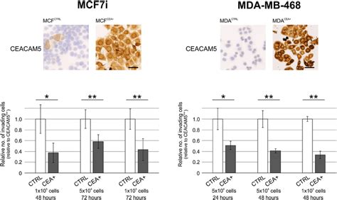 Ceacam5 Positive Breast Cancer Cells Are Less Invasive In Culture