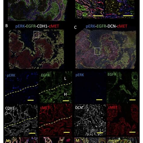 Bulksignalr For Spatial Transcriptomic Data Analysis A Spatial