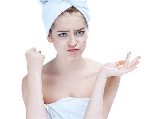 Urticaria Crónica Qué Es Causas Síntomas Y Tratamiento Para La Urticaria Crónica