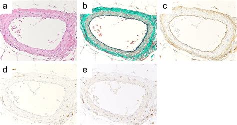 Histopathology And Immunostaining Of The Healthy Skin Resection