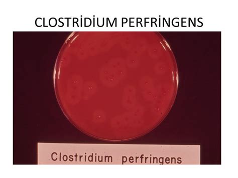 Clostridium Perfringens Antibiotic Treatment