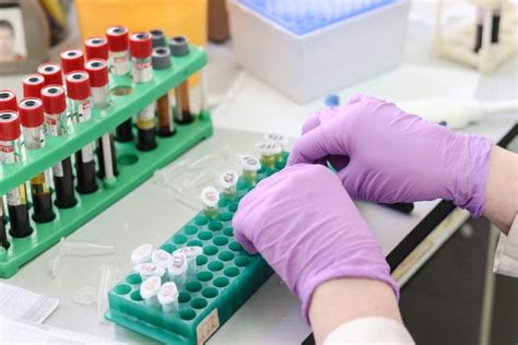 The Hiv Rna Test Window Period Everything You Need To Know Americans