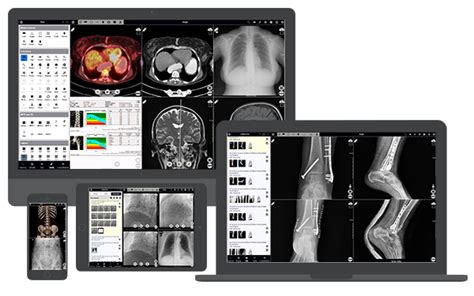 extremepacs ris and pacs radiology workflow is no longer under your