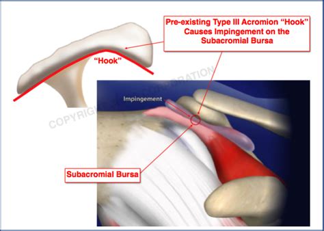 Juriscorps Medical Animations And Illustrations Can Help Win Your Case