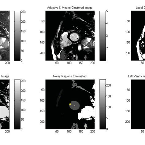 Fast Fully Automatic Left Ventricle Segmentation For Sample Mri Frame 4