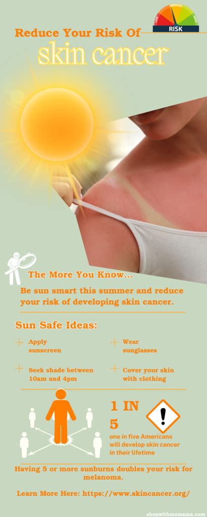 How Long Does Sunburn Last And Remedies For Sunburns Giveaway Shop