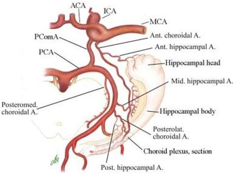 Posterior Choroidal Arteries Medical Anatomy Brain Anatomy