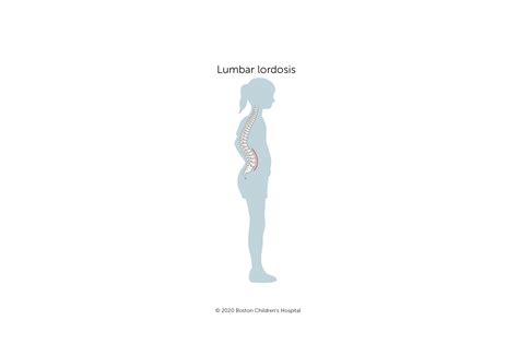 5 Types Of Posture Problems And How To Fix Your Posture Backembrace