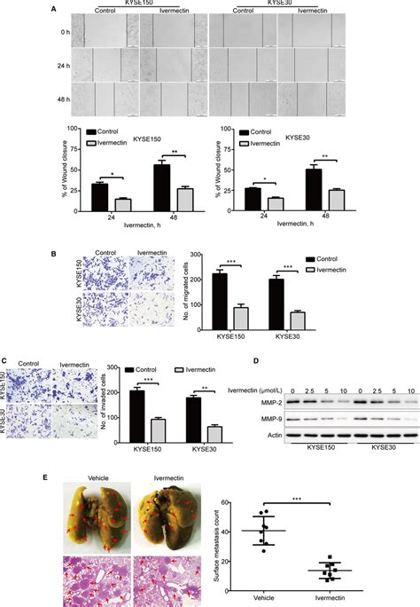 Ivermectin Suppresses Migration Invasion And Metastasis Of Escc Cells