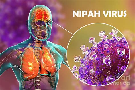 Encephalitis Caused By Nipah Viruses Photograph By Kateryna Kon Science