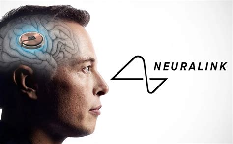 Công Ty Cấy Ghép Não Của Elon Musk Neuralink đã được Chấp Thuận