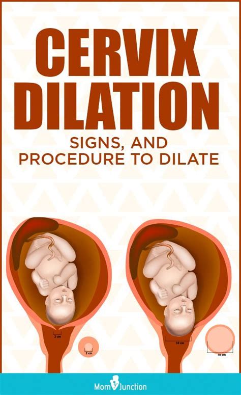 Cervix Dilation Signs And Procedure To Dilate