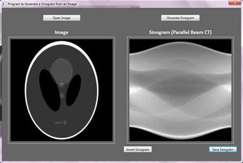 Computed Tomography Generation Of The Sinogram Image In C Codeproject