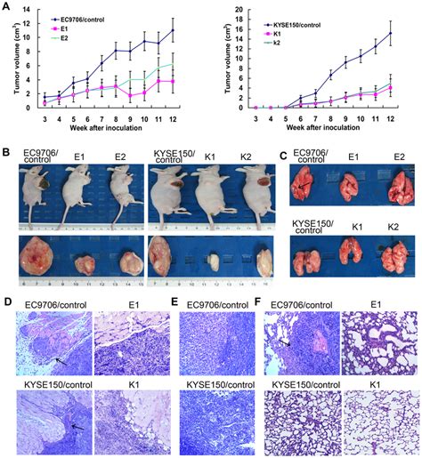 Knockdown Of Iqgap1 Expression Reduces Tumor Growth Invasion And