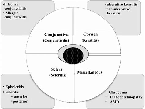 Common Ocular Disorders Associated With Various Tissues Of Eye