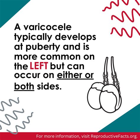 Varicocele Patient Education Fact Sheet