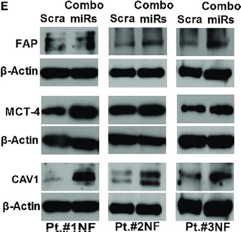 Differentially Expressed Mirnas In Fibroblasts Upon Exposure To