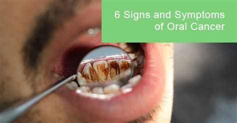 6 Signs And Symptoms Of Oral Cancer