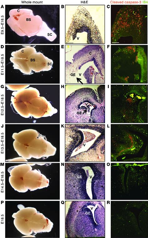 Spatiotemporal Mapping Of A Developmental Transition To A Download