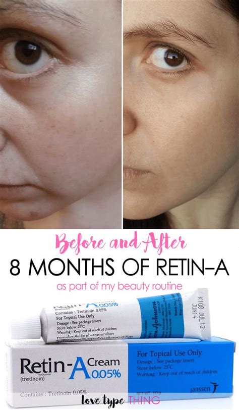 How Much Retinol To Use For Beginners At Joyce Greene Blog