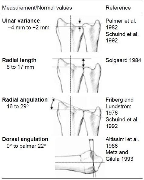 Radiographic Parameters Download Scientific Diagram