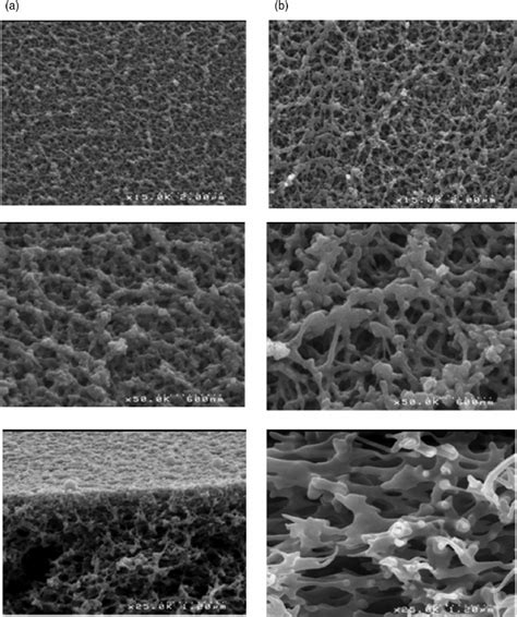 Scanning Electron Microscopy Micrographs For The Membranes 1 Surface