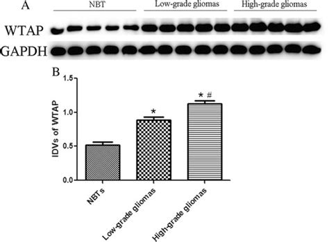 Expression Of Wtap Was Detected By Wb In Glioma Tissues And Normal
