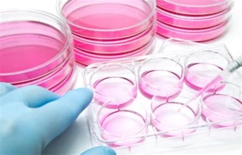 Senescent Cells Perturb Intestinal Stem Cell Differentiation Through