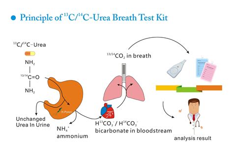 Urea Breath Test Medizzy