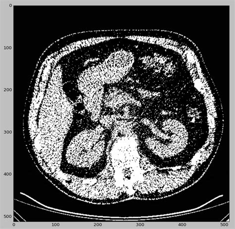 dicom python read and convert raw 3d image file stack