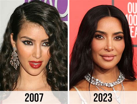 Fans Think Kim Kardashian Got Another Nose Job After Seeing Before And