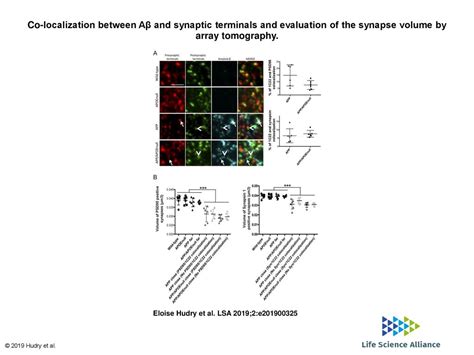 Co Localization Between Aβ And Synaptic Terminals And Evaluation Of The
