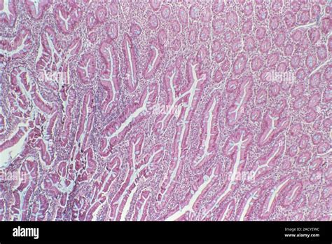 Small Intestine Lining Light Micrograph Of A Section Through Villi