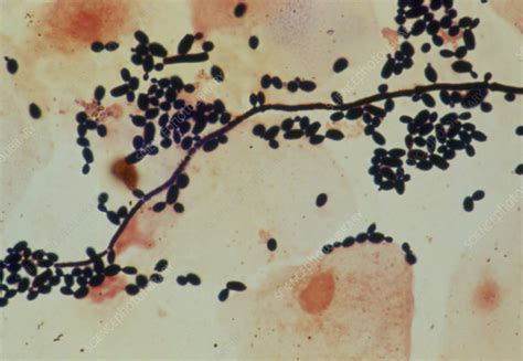 Lm Of Candida Albicans Found In Vaginal Smear Stock Image M862 0016