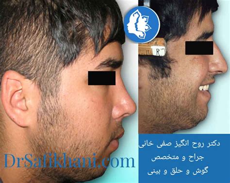 ارتباط با دکتر صفی خانی دکتر روح انگیز صفی خانی جراح و متخصص گوش و