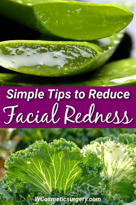 5 Tips To Reduce Facial Redness – Artofit