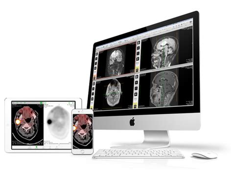 osirix md医疗图像处理软件12 0版本已正式发布 北京环中睿驰科技有限公司