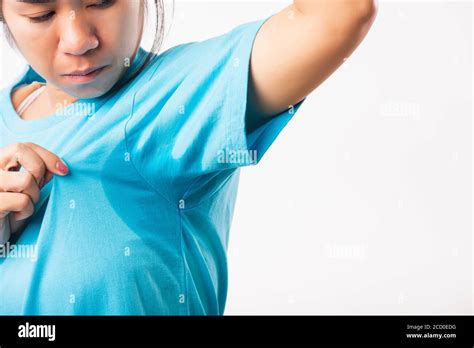 Hyperhidrosis Underarms