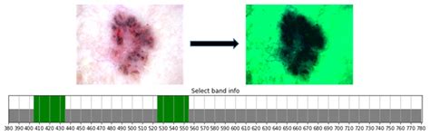 Jcm Free Full Text Classification Of Skin Cancer Using Novel