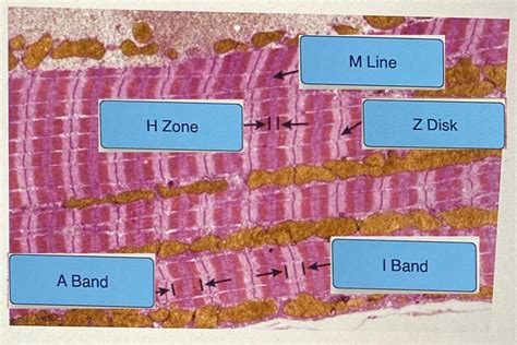 [solved] Help Ick And Drag The Labels Of The Sarcomere To Their